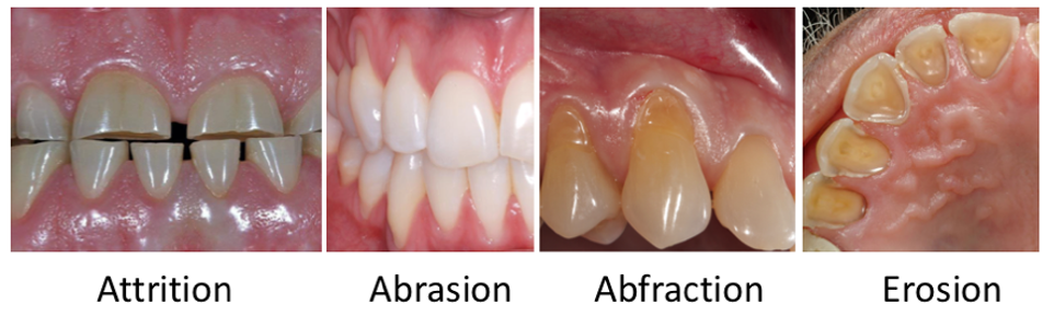 Zubić Iva Blog | Edukativni blog o dentalnoj medicini.